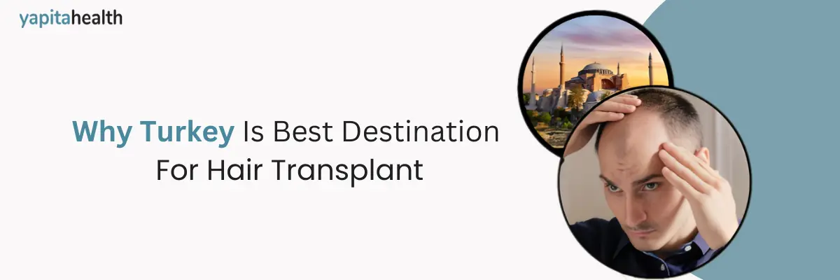 Why Turkey Is Best Destination For Hair Transplant
